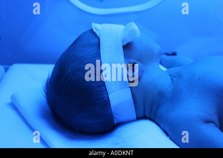 Premature baby with jaundice having phototherapy Stock Photo - Alamy