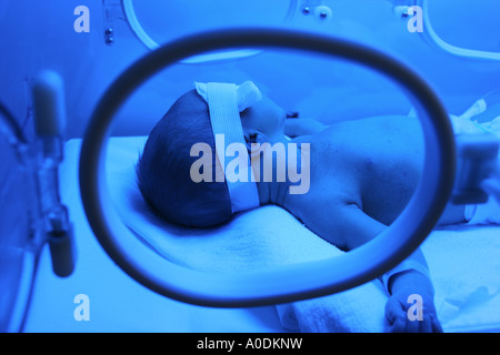 Premature baby with jaundice having phototherapy Stock Photo - Alamy