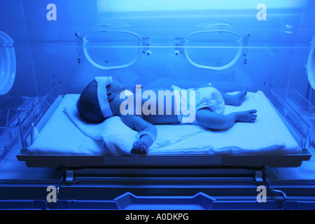 Premature baby with jaundice having phototherapy Stock Photo - Alamy