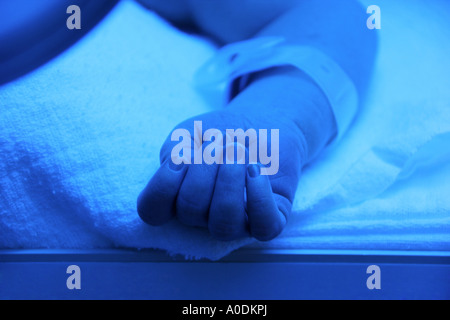 Premature baby with jaundice having phototherapy Stock Photo - Alamy