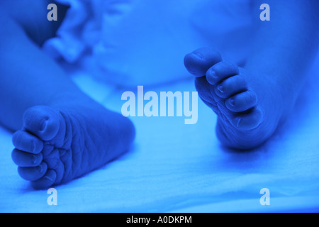 Premature baby with jaundice having phototherapy Stock Photo - Alamy
