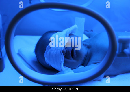Premature baby with jaundice having phototherapy Stock Photo - Alamy