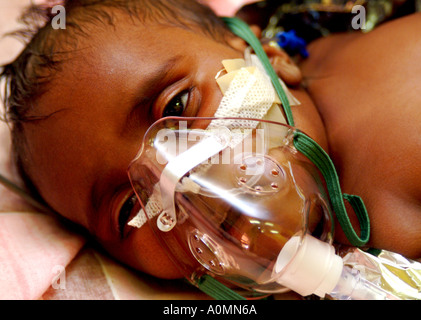 sick aboriginal child Northern Territory, Australia, photo by Bruce ...