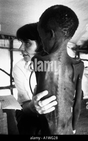 South Sudan Ajiep Famine Malnourished boy in front of Buffalo transport ...