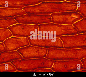 ONION SKIN CELLS (EPIDERMAL CELLS) SHOWS CELL STRUCTURE AND NUCLEUS STAINED IN IODINE / LIVE ...
