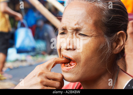 Teeth of a Betel Nut Chewer Stock Photo - Alamy