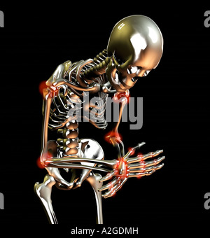 Skeleton illustrating Wrist Pain Stock Photo - Alamy