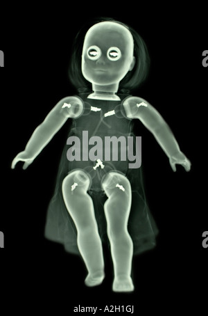 xray of a doll Stock Photo - Alamy