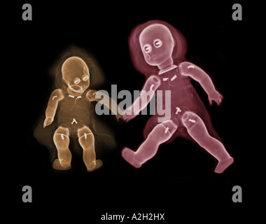 colorized xray of a childs dolls Stock Photo - Alamy