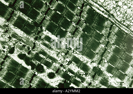 A transmission electron micrograph (TEM) of skeletal muscle in cross section Stock Photo - Alamy