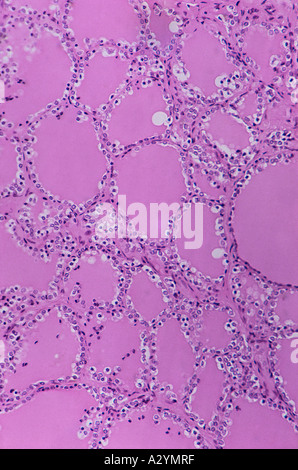 Follicles of colloid in thyroid Stock Photo - Alamy