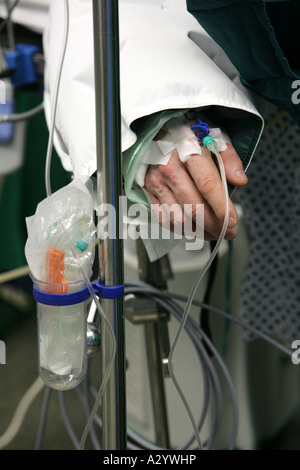 DEU Germany Patient during a surgery artificial respiration Monitoring ...