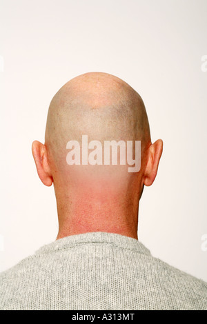 Back of bald man's head Stock Photo - Alamy