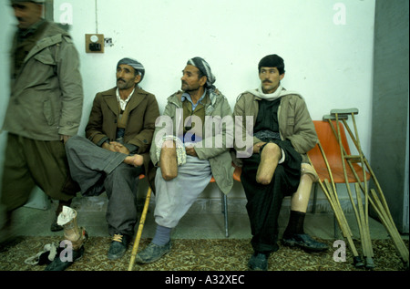 Kurdistan, Iraq: Farmers who lost limbs to landmines at a prosthetic ...