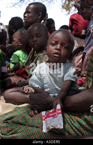 Plumpy nut an RUTF F100 formula a food supplement supplied by the WFP ...