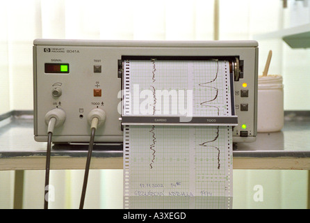 apparatus or device the unit of measurement of the electrocardiogram in ...