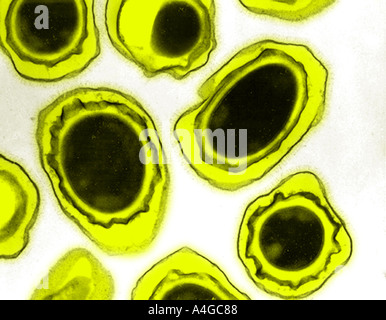 Anthrax spores from a US Department of Defense electron micrograph ...