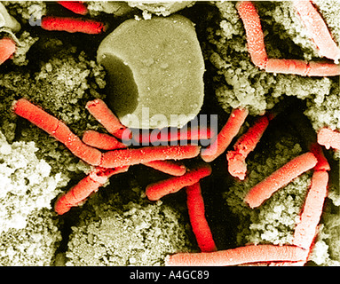 Anthrax Bacillus anthracis vegetative cells in monkey spleen Stock ...