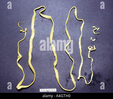 Taenia solium, pork tapeworm Stock Photo: 66712114 - Alamy