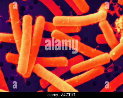 Scanning electron micrograph (SEM) of Bacillus anthracis spore and ...