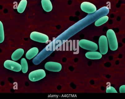 Scanning electron micrograph (SEM) of Clostridium perfringens, Gram ...