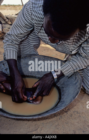 Dracunculus medinensis, Guinea Worm Extraction Stock Photo - Alamy