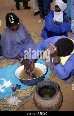 Dracunculus medinensis, Guinea Worm Extraction Stock Photo - Alamy