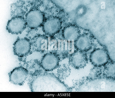TEM Transmission Electron Microscope of AIDS virus Stock Photo - Alamy