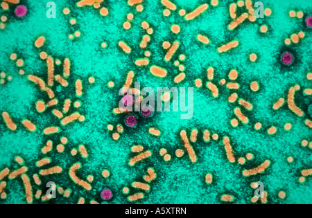 electron microscope image of hepatitis B Dane particles Computer Stock ...