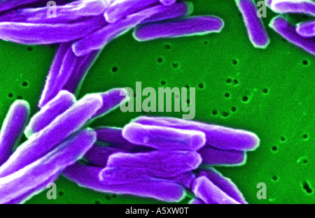 scanning electron micrograph showing the ultrastructural details seen in the cell wall ...
