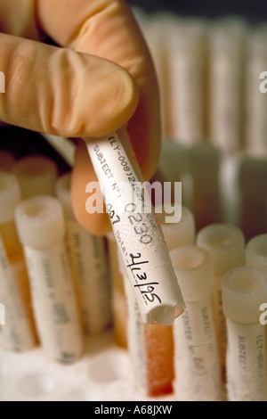 Frozen blood samples used in research study Stock Photo - Alamy