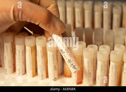 Frozen blood samples used in research study Stock Photo - Alamy