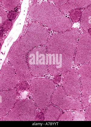 TEM of Skeletal Muscle Stock Photo - Alamy