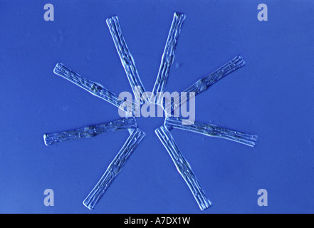 Tabellaria flocculosa.Diatom.Seawed.Algae.Optic microscopy Stock Photo ...