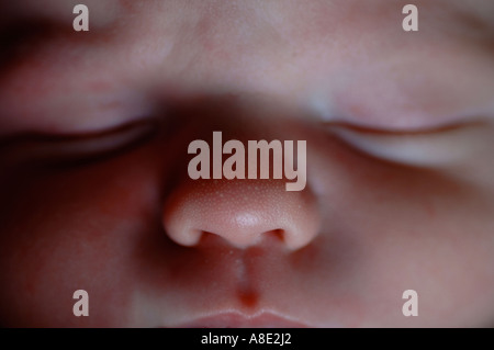 Milk spots or milia on baby's nose Stock Photo - Alamy