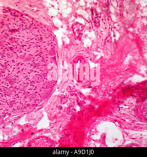 Human suprarenal capsule detail Stock Photo - Alamy