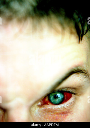 Boxer, injured and black man fighter face with a serious sport injury ...