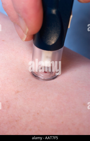 Penlet device for measuring blood sugar Stock Photo - Alamy