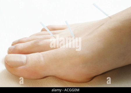 Man with many acupuncture needles in face, Beijing, China Stock Photo ...