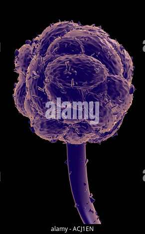 Toxic mould spores (Stachybotrys chartarum), computer illustration ...