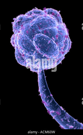 Toxic mould spores (Stachybotrys chartarum), computer illustration ...
