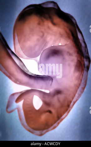 Human amnion, amniotic sac Stock Photo - Alamy