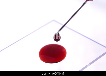 microscope slide, sample and hypodermic needle Stock Photo - Alamy