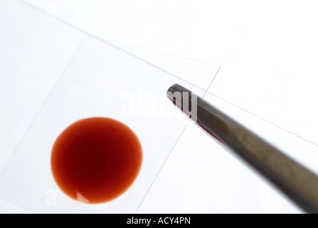 Microscope slide, forceps, cover slip with blood sample isolated on ...