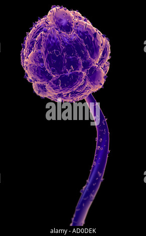 Toxic mould spores (Stachybotrys chartarum), computer illustration ...