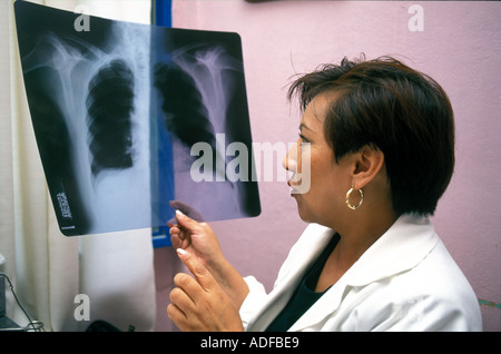 X ray department at an NHS hospital in UK Stock Photo: 20867169 - Alamy