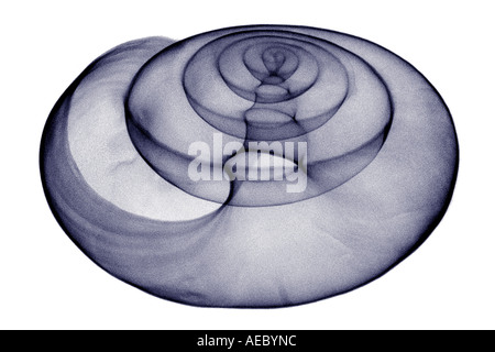X-ray radiograph of a land snail shell (Zonites algirus). Radiographie ...