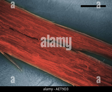 woman s hair by scanning electron microscope showing split end Black ...