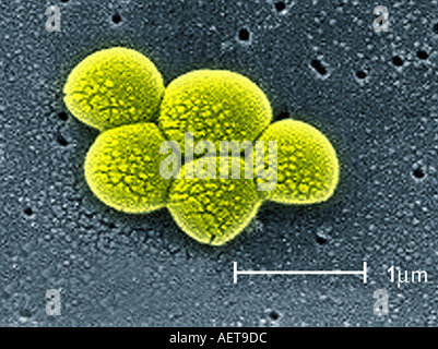 scanning electron microscope image of MRSA staphylococcus bacteria ...