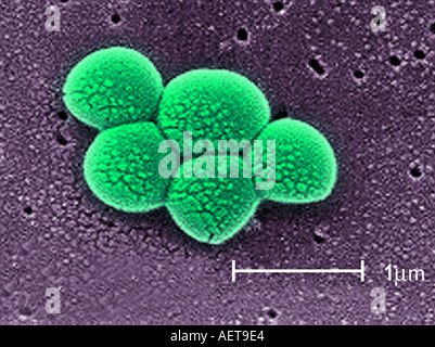 scanning electron microscope image of MRSA staphylococcus bacteria ...